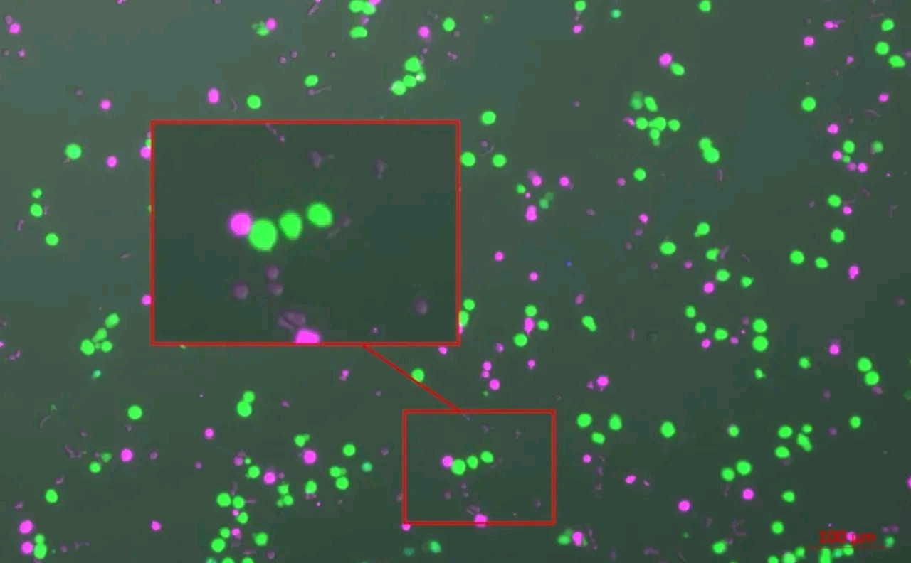 Cell重磅：余建华团队发现并解析ILC2细胞的抗癌机制，可对抗各种肿瘤，改变细胞治疗格局！