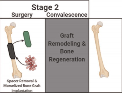Masquelet 技术 —— 骨缺损修复术-健康160