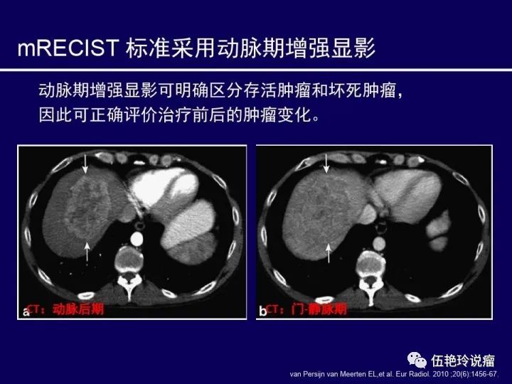 实体肿瘤疗效评估方法进展 --mRECIST 标准